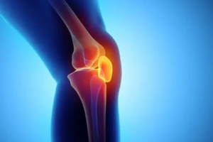 Understanding Bone Dislocations: Everything You Need to Know - Dr ...
