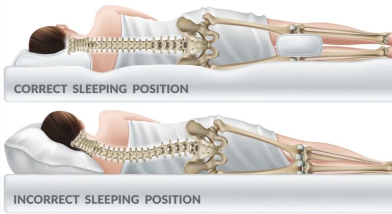 Best Sleeping Positions for Lower Back Pain Relief: Expert Guide & Tips